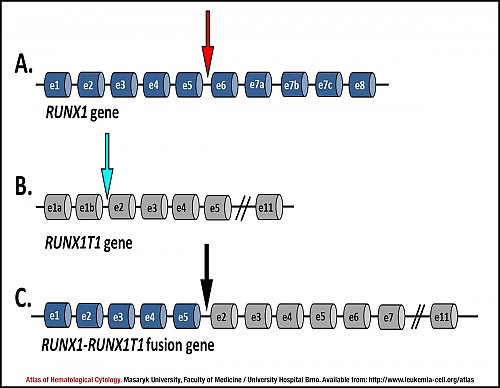 Acute Myeloid Leukaemia With T821q22q22 Runx Runx1t1 Cell 5174