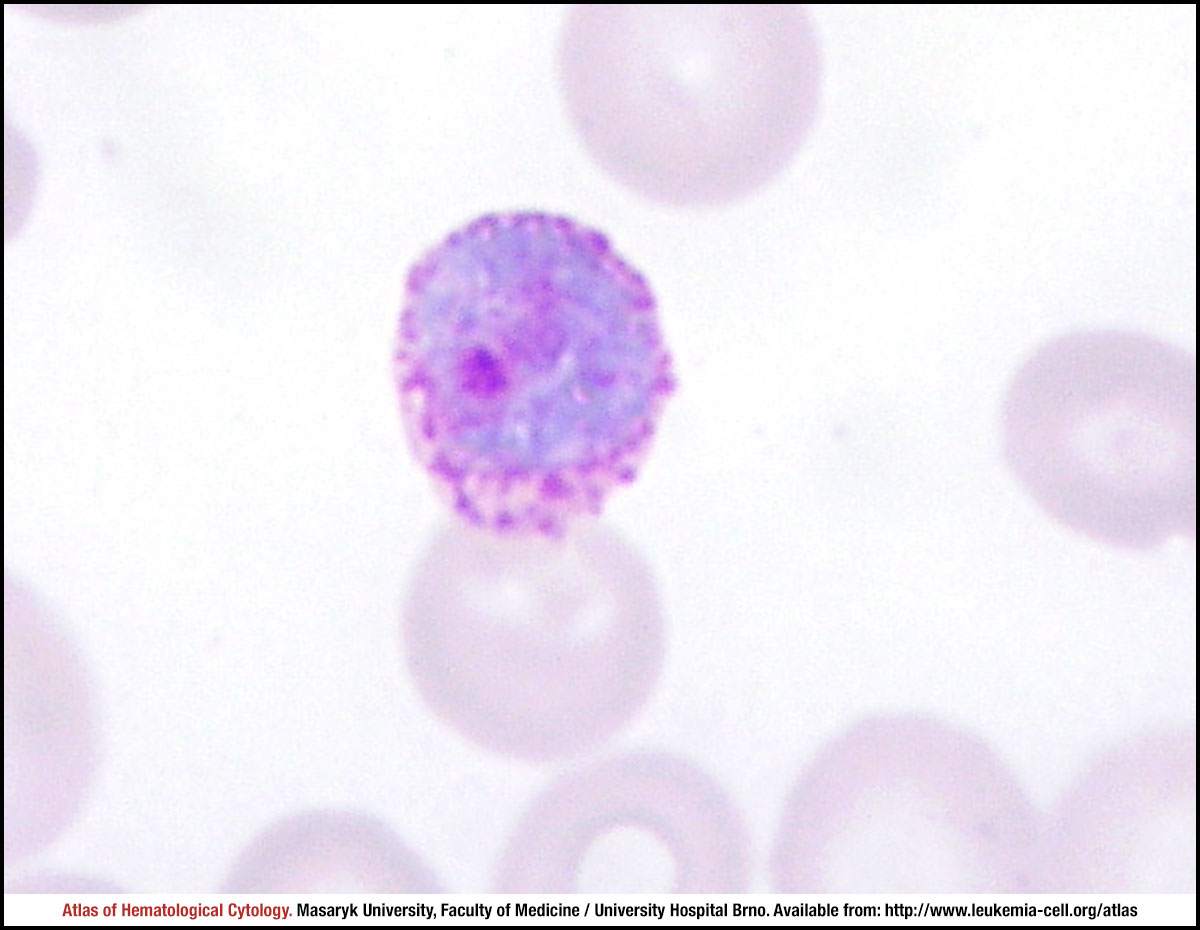 Plasmodium ovale - CELL - Atlas of Haematological Cytology
